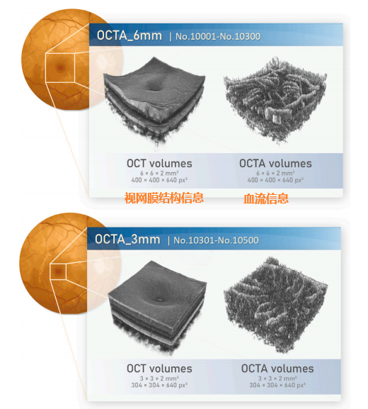 【论文阅读】OCTA-500: 一个光学相干断层扫描血管成像研究的眼底数据集 - SuXiaofei's Blog
